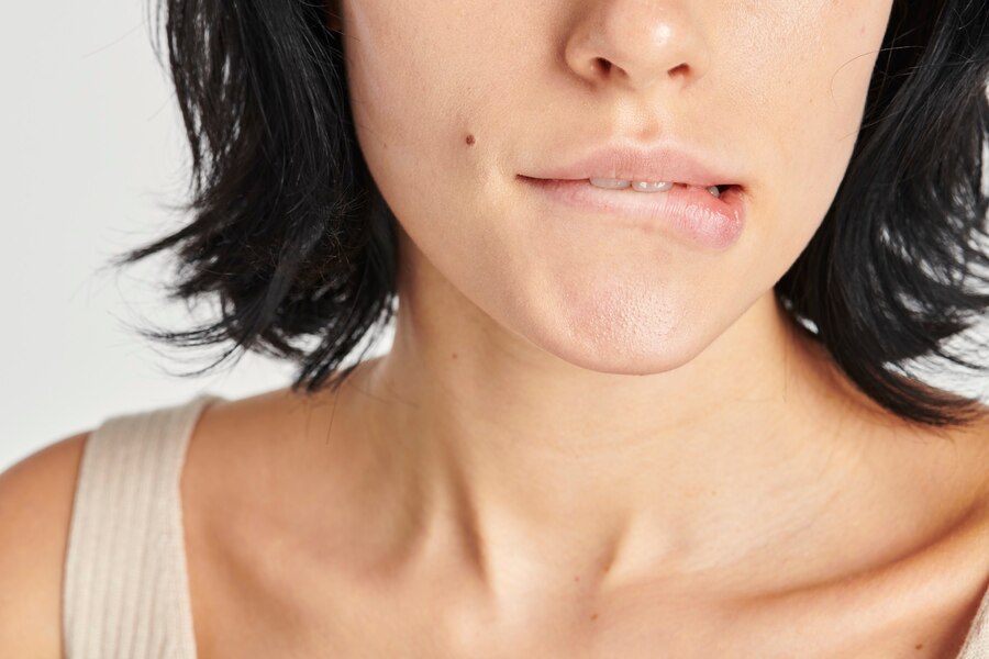 Angular Cheilitis: Prevention, Causes, and Effective Treatment